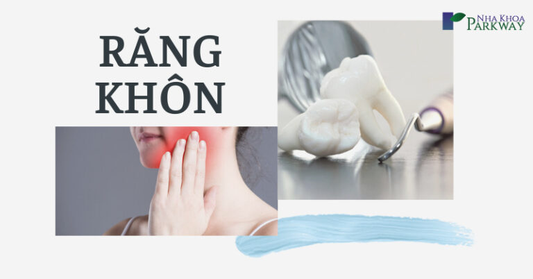 Răng khôn mọc ở đâu? Răng khôn là gì? Quy trình như thế nào?