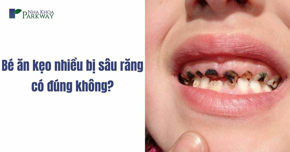 Nha khoa Parkway - Hệ thống nha khoa chuyên niềng răng