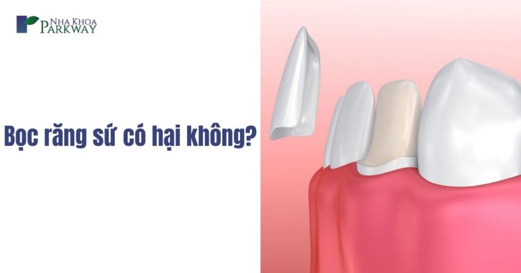 Con sâu răng là gì? Hình ảnh cách bắt con sâu răng thật không?