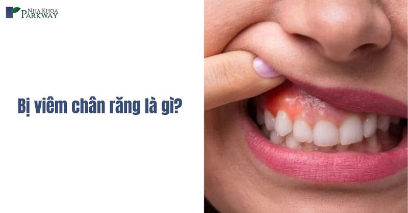 Bọc răng sứ cho răng sâu bao nhiêu tiền? Quy trình có đau không?