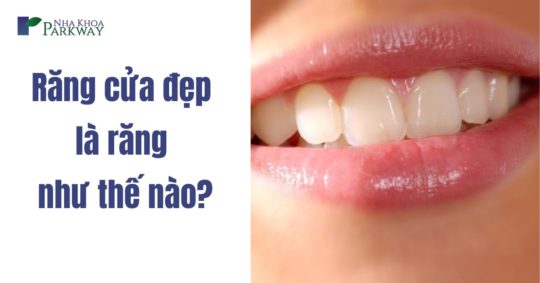 Răng cửa đẹp là răng như thế nào? Những tiêu chuẩn đánh giá