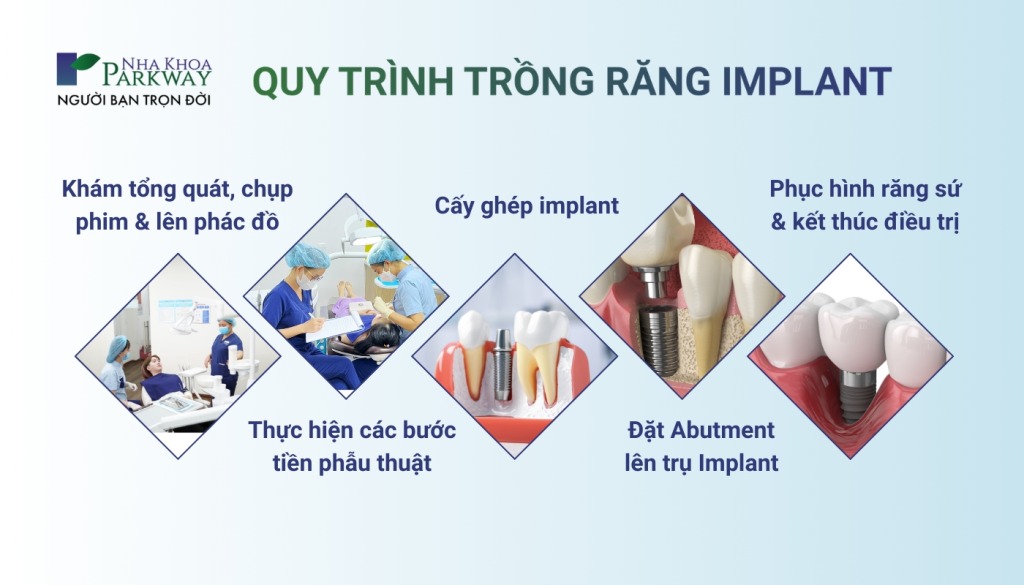 Dịch vụ trồng răng Implant Dentium dòng Super Line, NR line, SlimLine | Nha Khoa Parkway