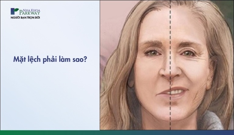 Mặt lệch phải làm sao? 8 mẹo khắc phục mặt lệch tại nhà